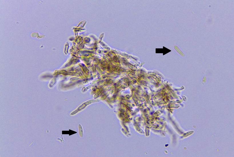 Infectário - Departamento de Fitopatologia